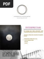 Tabel WHO Dan Contoh Zscore LENGKAP | PDF