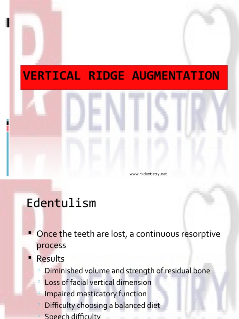 Vertical Ridge Augmentation | PDF | Dental Implant | Bone