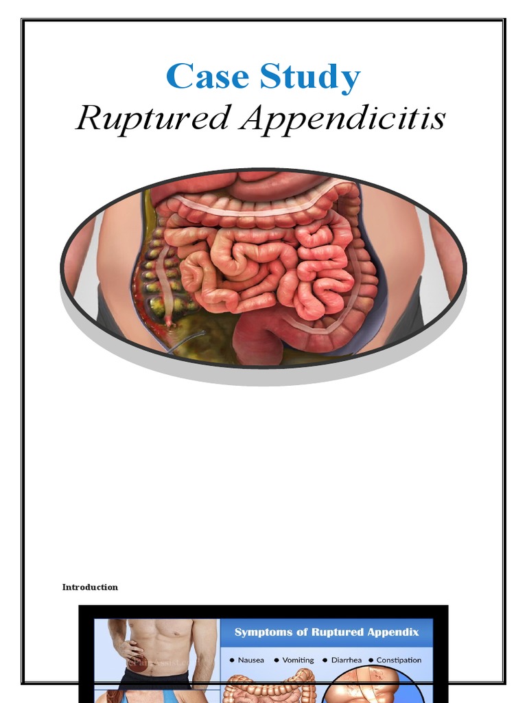 Case Study Appendicitis | PDF | Human Digestive System | Digestion