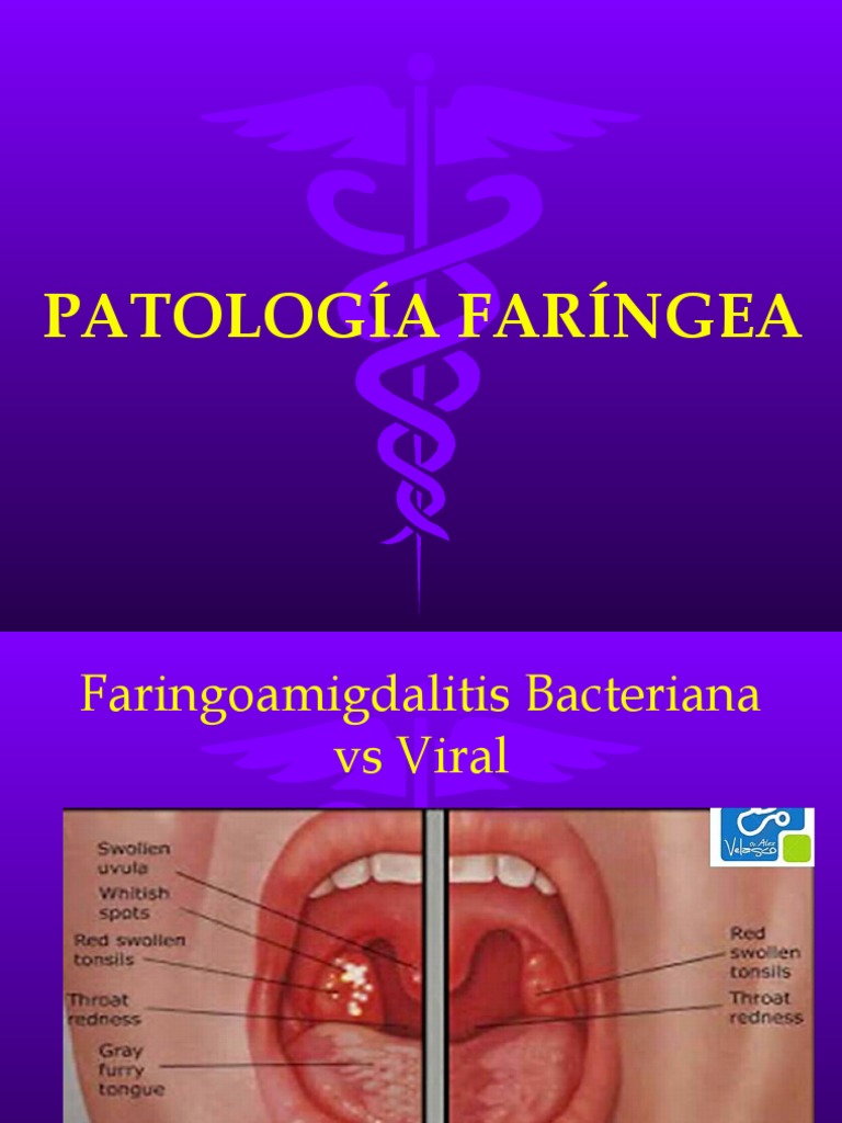 Patología Faríngea Simulación | PDF