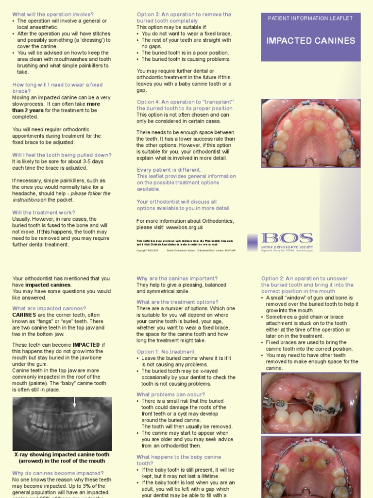 Impacted Canines: Patient Information Leaflet | PDF | Orthodontics | Tooth