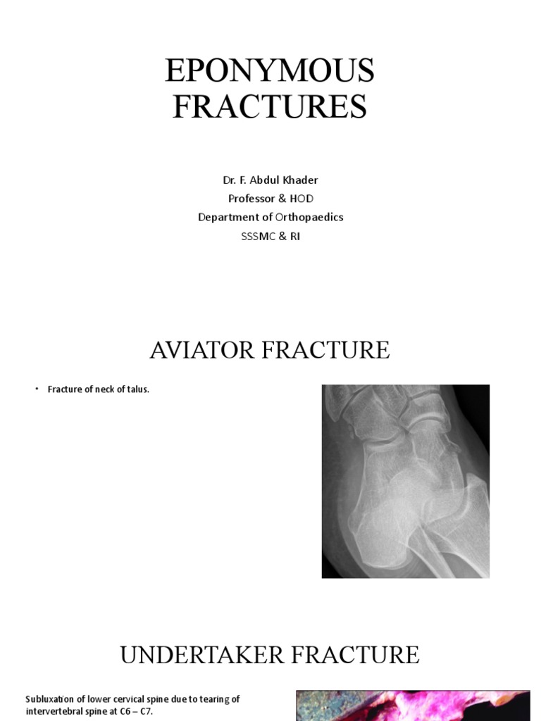 Eponymous Fractures Overview | PDF | Wellness | Science & Mathematics
