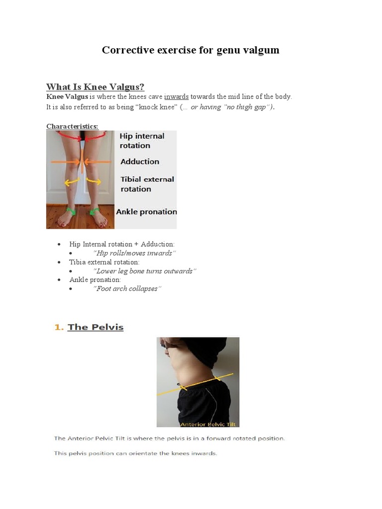 Best Exercises for Genu Valgum Correction | PDF | Wellness