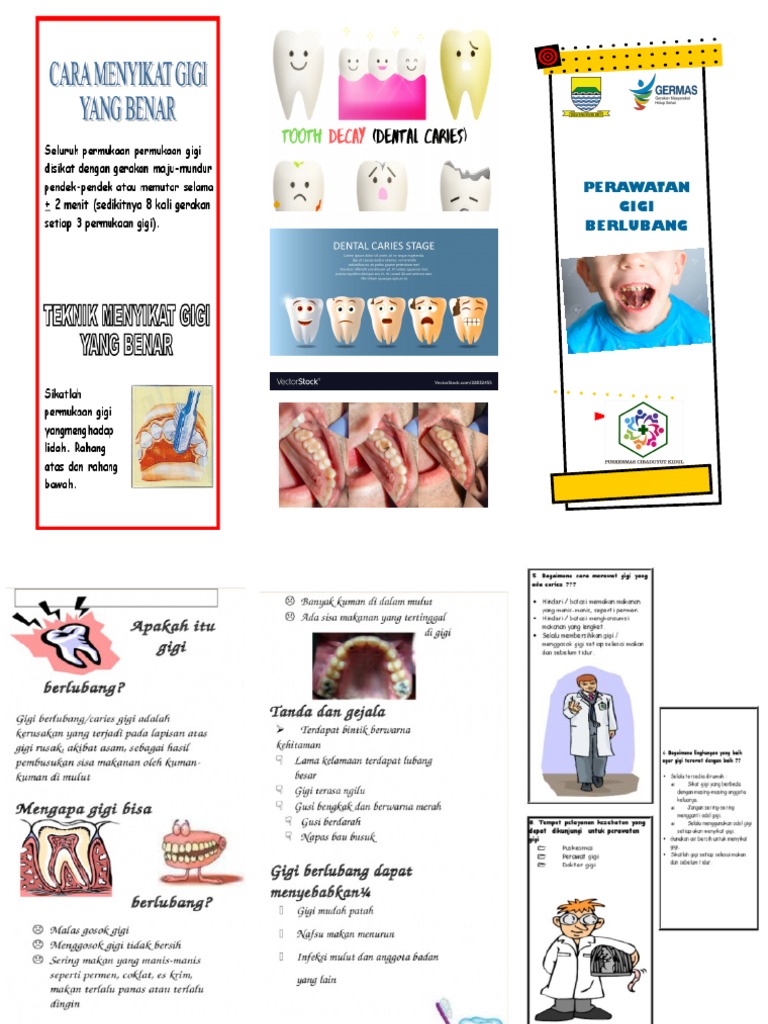 Perawatan Gigi Berlubang: Back Panel Heading | PDF