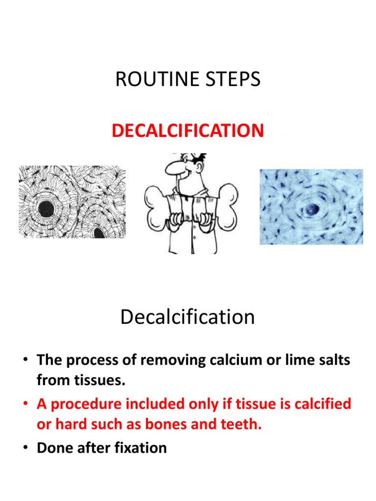Routine Steps: Decalcification | PDF | Ethylenediaminetetraacetic Acid ...