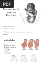 Presentación Podálica o de Nalgas | PDF | Parto | Reproducción humana