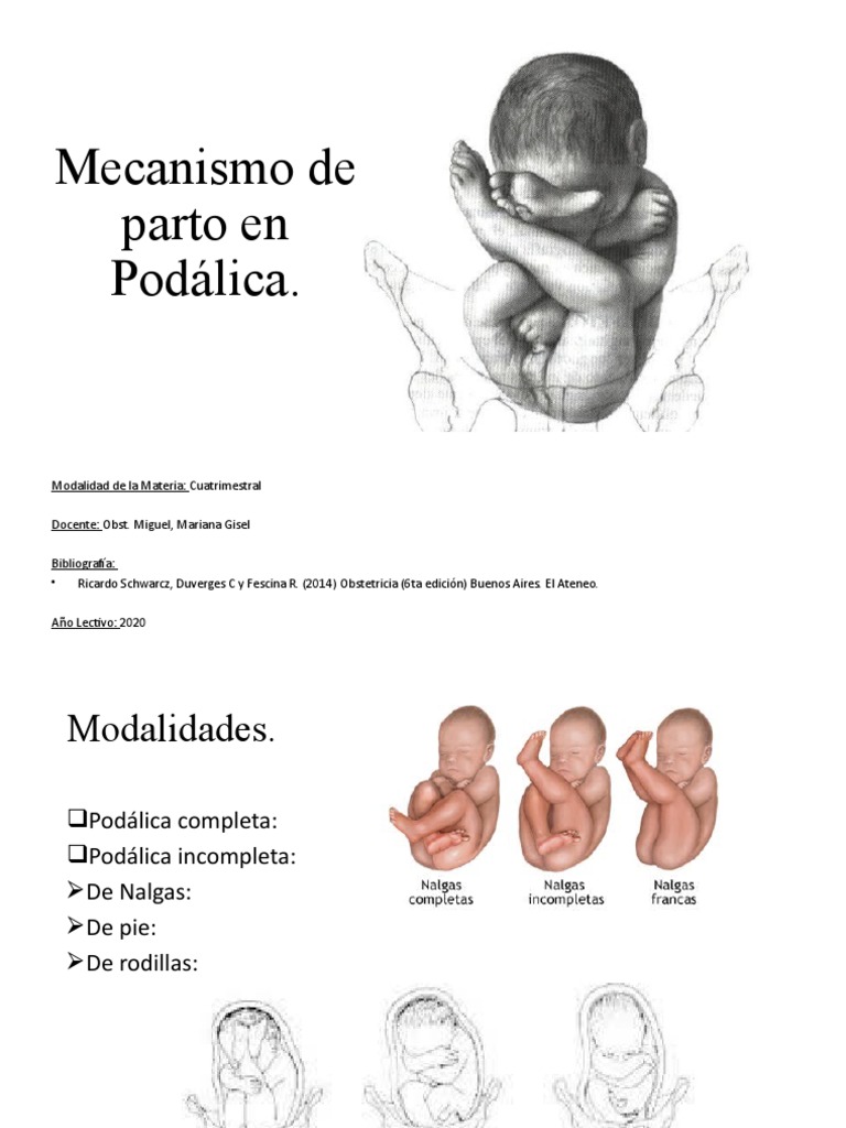 Mecanismo de Parto en Podálica | PDF | Parto | Reproducción humana