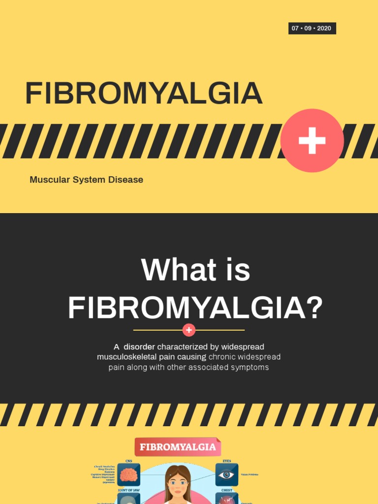 Fibromyalgia | PDF