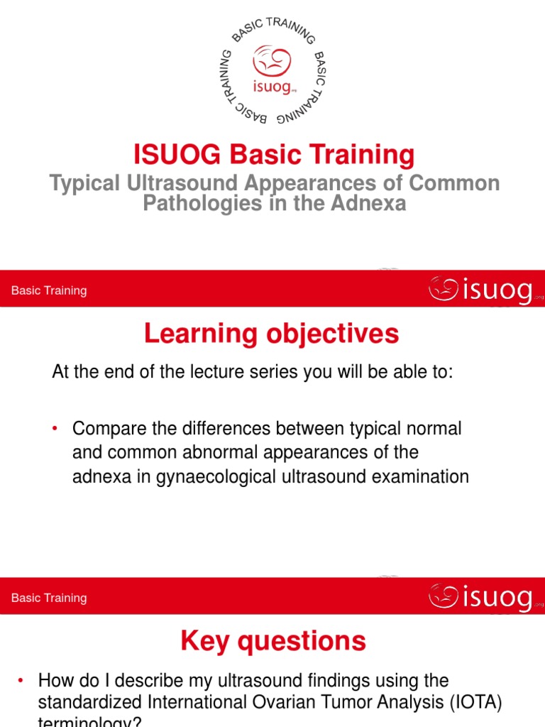 Isuog USG | PDF | Ovarian Cancer | Ovary