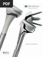 Protesis de Thompson Espanol SCECLE | PDF | Cirugía | Medicina CLINICA