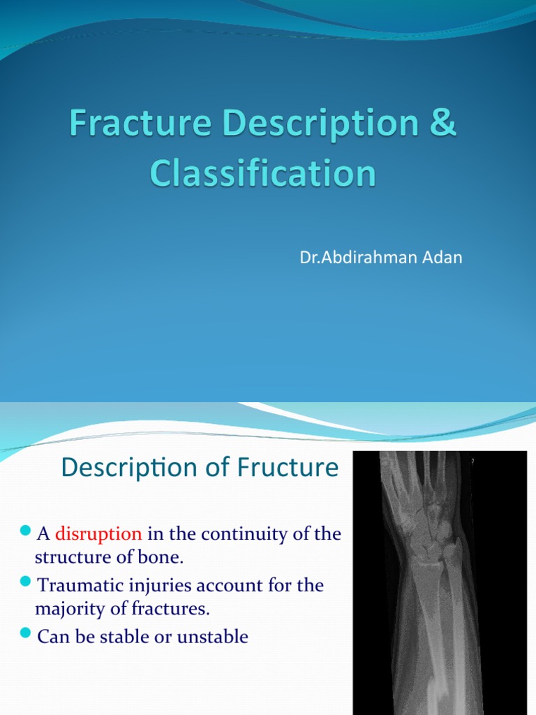 Comprehensive Guide to Fracture Classification | PDF | Musculoskeletal ...