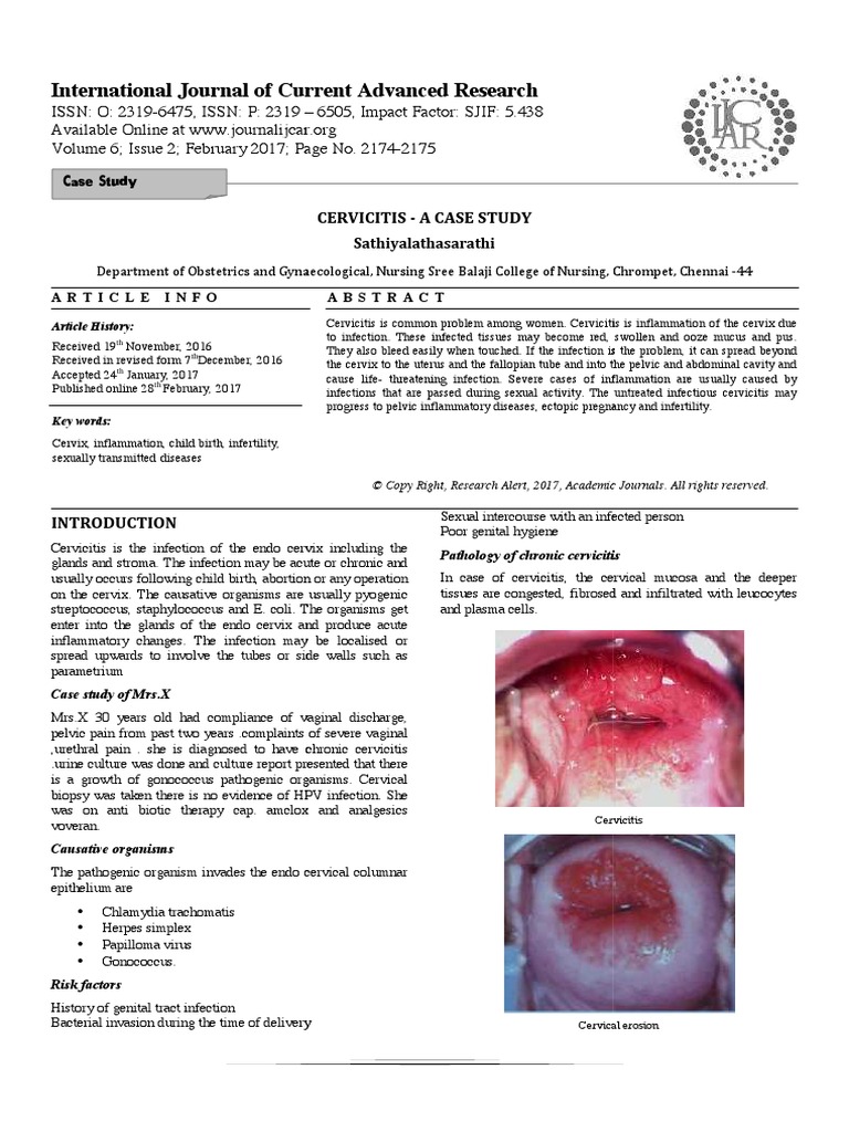 Servisitis | PDF | Vagina | Cervical Cancer