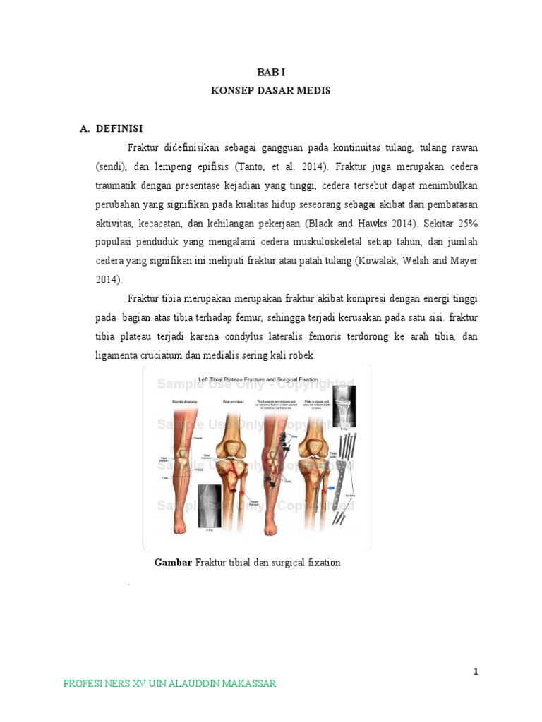 Protokol Penanganan Fraktur Tibia | PDF | Sains & Matematika