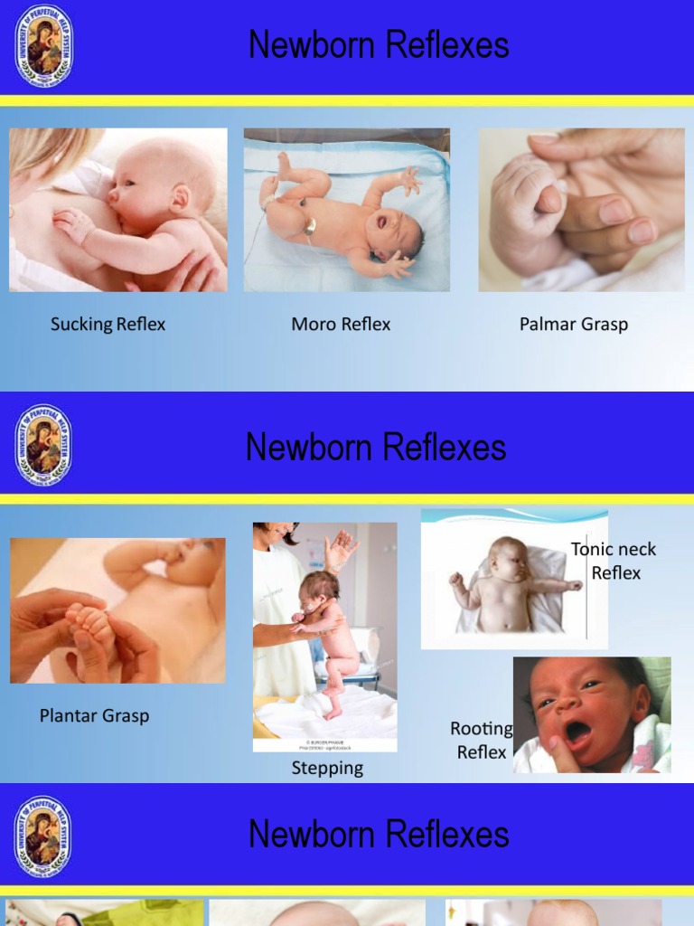 4 2 Newborn Reflexes | PDF