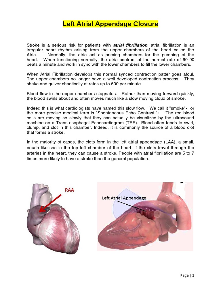 Left Atrial Appendage Closure | PDF | Cardiovascular Diseases | Angiology
