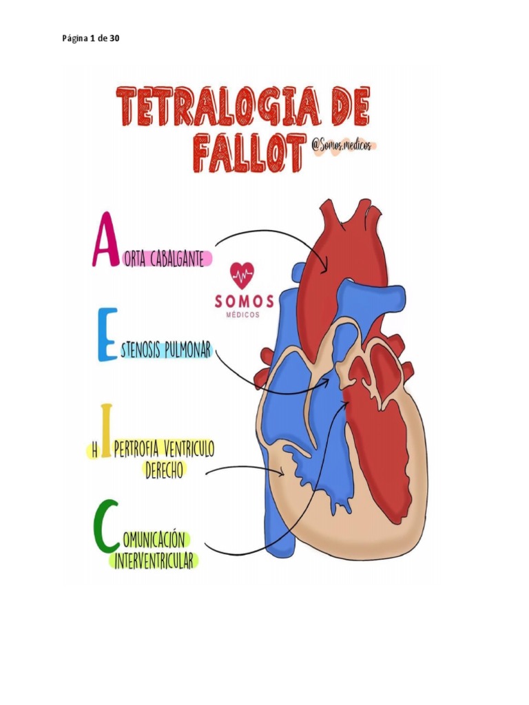 Tetralogia de Fallot | PDF | Corazón | Enfermería