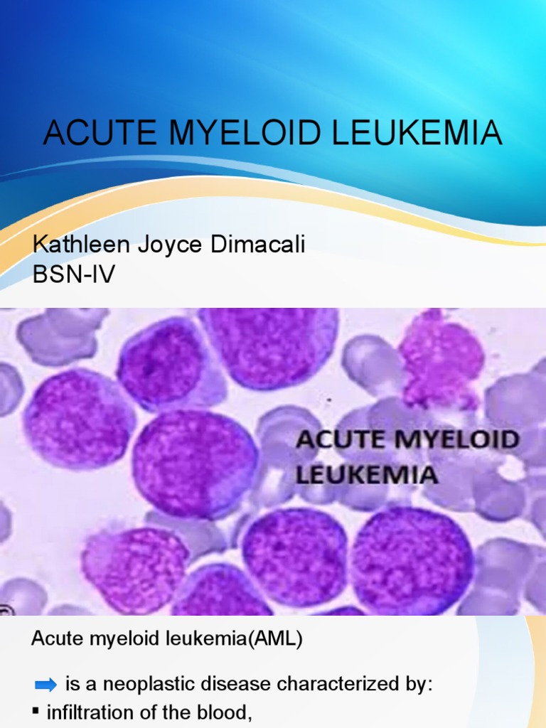 Acute Myeloid Luekemia | PDF | Leukemia | Chemotherapy