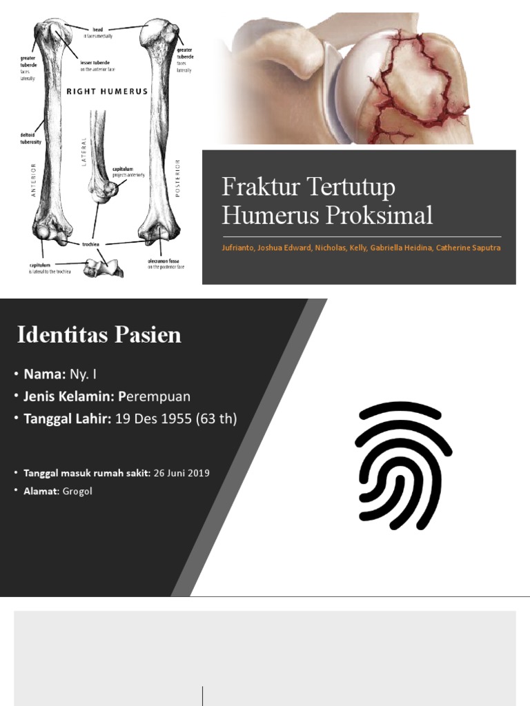 Fraktur Tertutup Humerus Proksimal | PDF