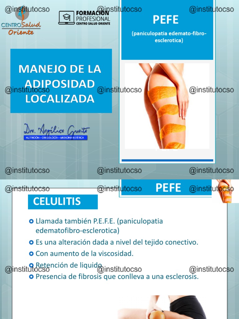 PEFE | PDF | Edema | Especialidades Medicas