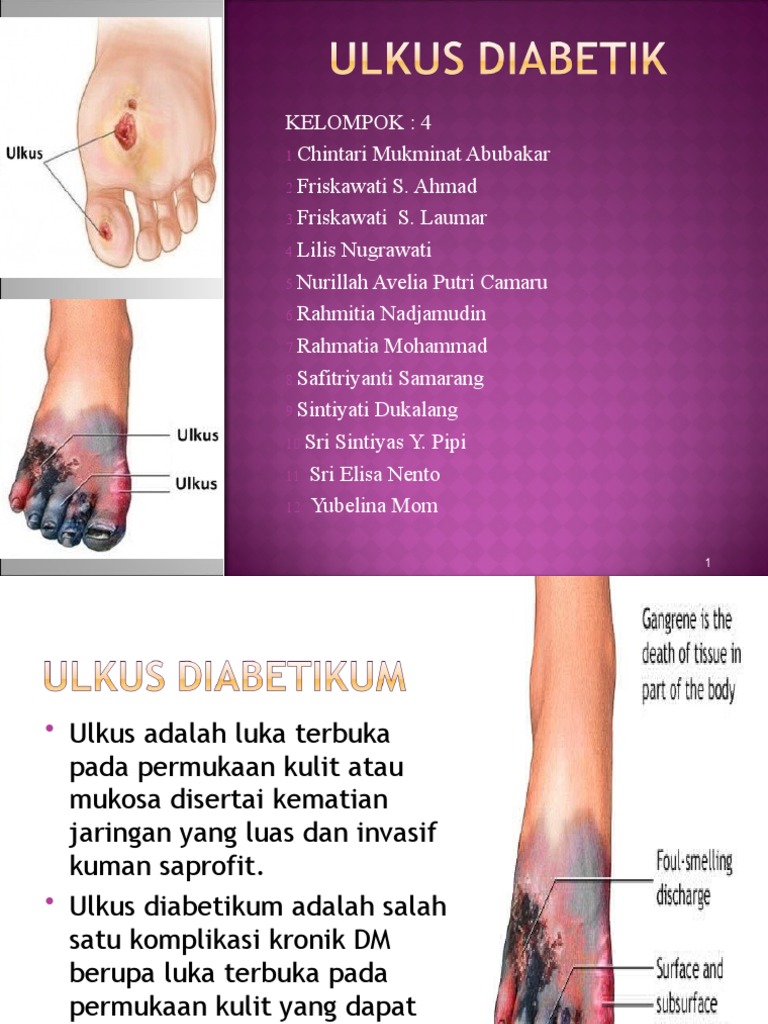 KMB Ulkus Diabetik Kelmpk 4 | PDF