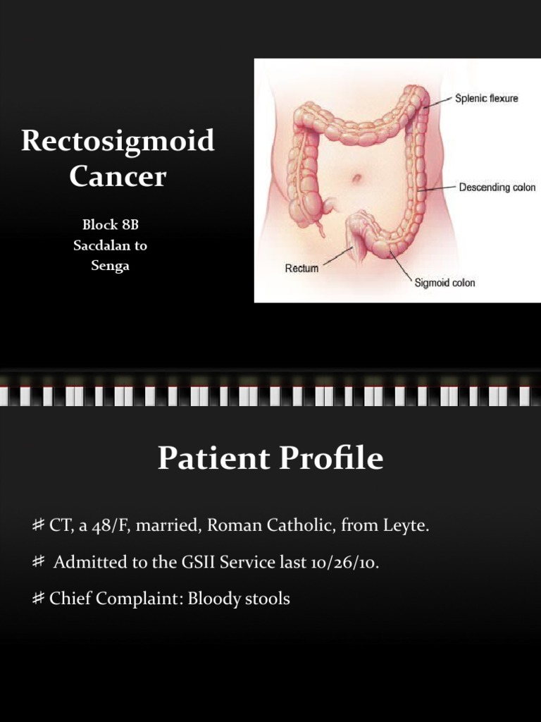 Rectosigmoid Cancer: Block 8B Sacdalan To Senga | PDF | Colorectal ...