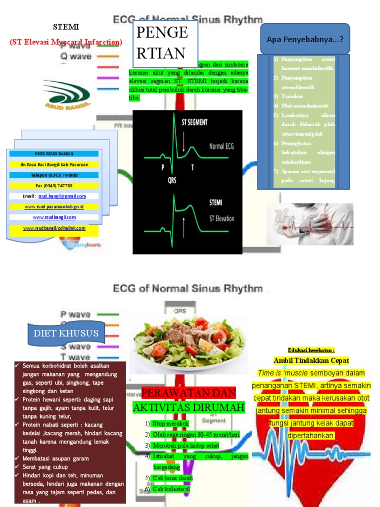 Leaflet STEMI REVISI | PDF