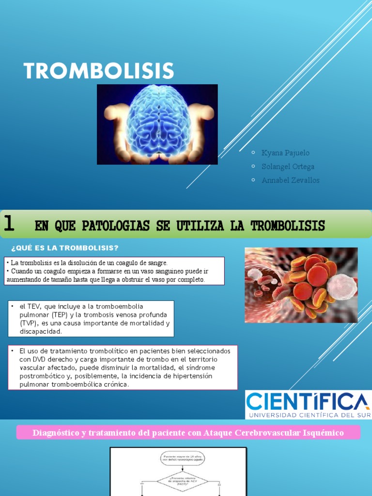 Uso y Beneficios de la Trombólisis | PDF | Trombo | Ciencias de la Salud