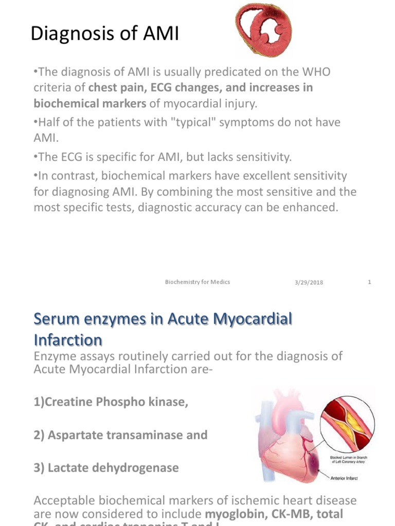 Diagnosis of AMI: Biochemical Markers of Myocardial Injury | PDF ...
