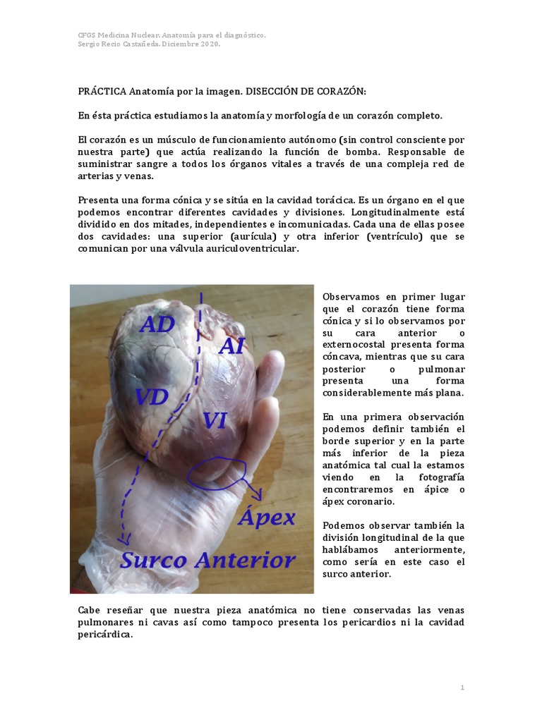 Disección de Corazón | PDF | Ventrículo (corazón) | Corazón
