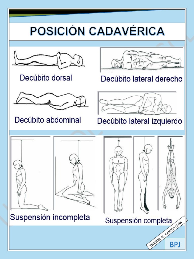 Posiciones Cadavéricas en Criminalística | PDF