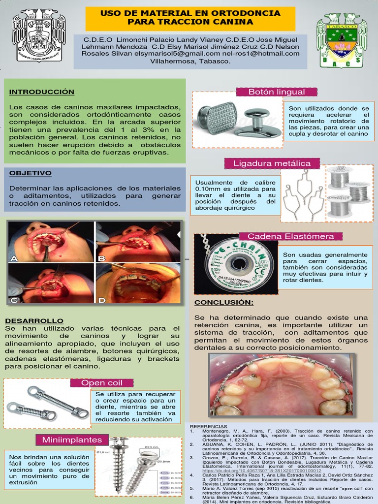Cartel Materiales Dentales para Tracci N de Canino1 Q | PDF | Ortodoncia | Ramas de Odontología