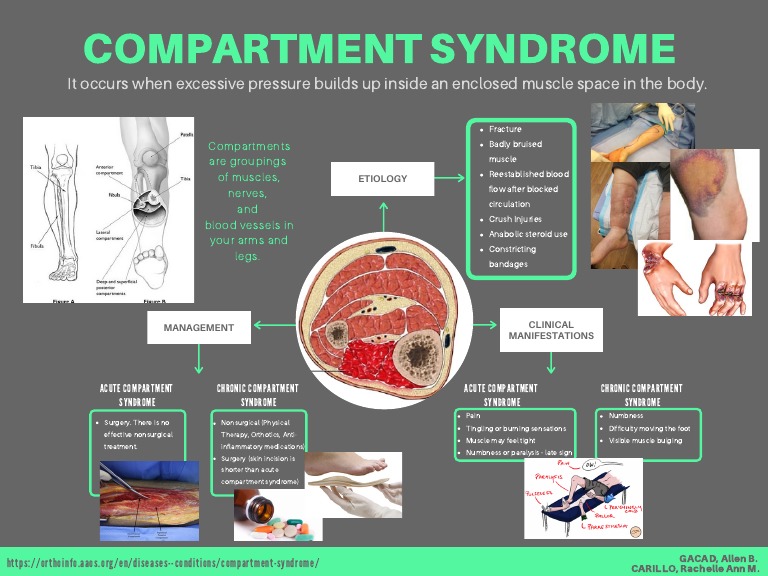 Compartment Syndrome: It Occurs When Excessive Pressure Builds Up ...