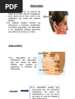 Adenoiditis Aguda | PDF | Ciencias de la Salud | Medicina