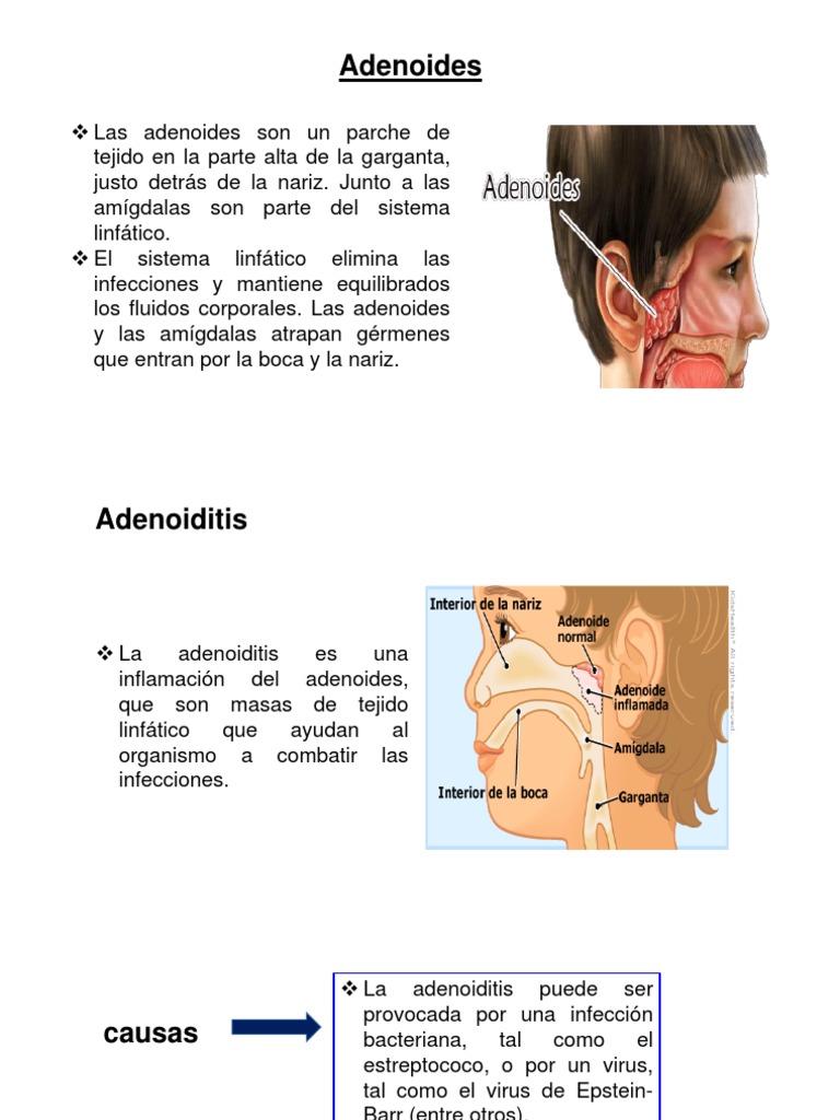 Adenoides | PDF | Apnea del sueño | Inmunología