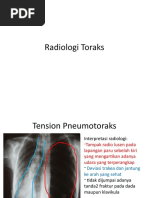 Anatomi Thorax Normal + Gambaran Radiologi | PDF
