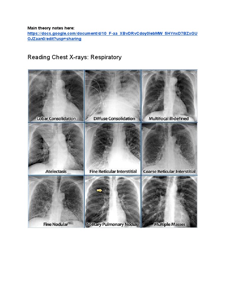 Reading X-Rays | PDF | Bone | Lung