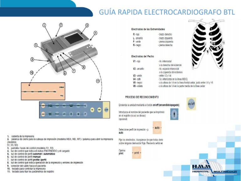 Guia Rapida EKG BTL | PDF