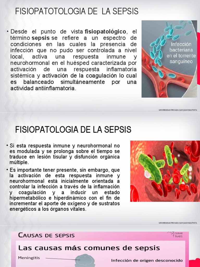 Fisiopatotologia de La Sepsis | PDF | Septicemia | Infección
