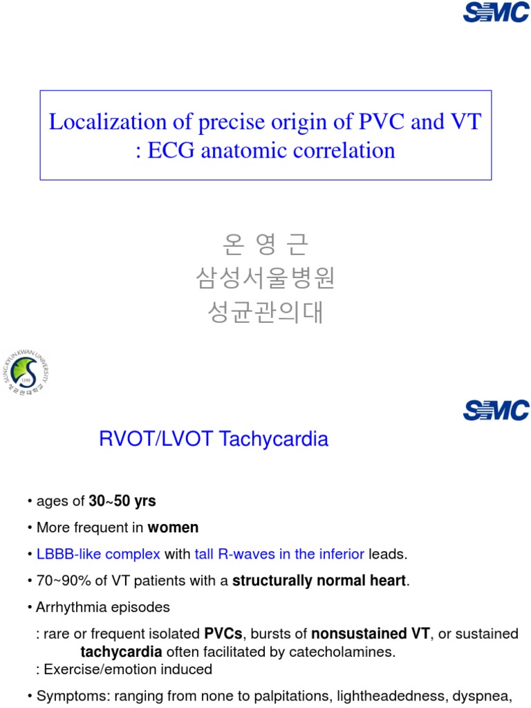 PVC and VT Origin Localization in ECG | PDF | Electrocardiography ...