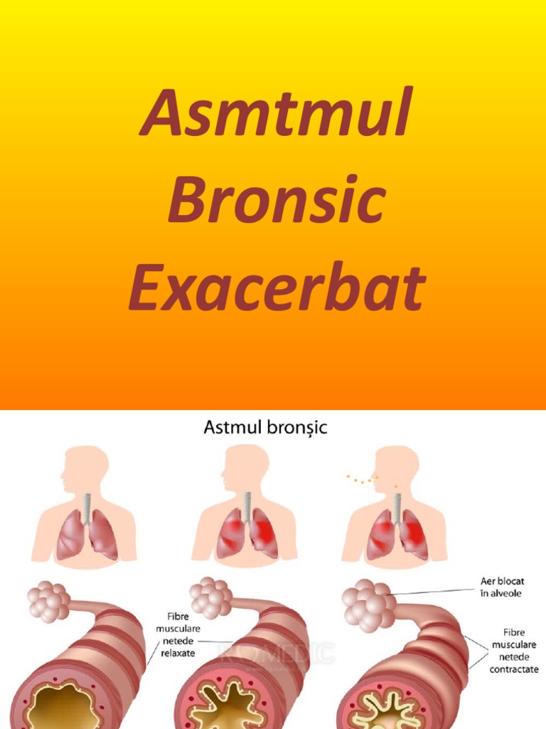 Astmul Exacerbat | PDF
