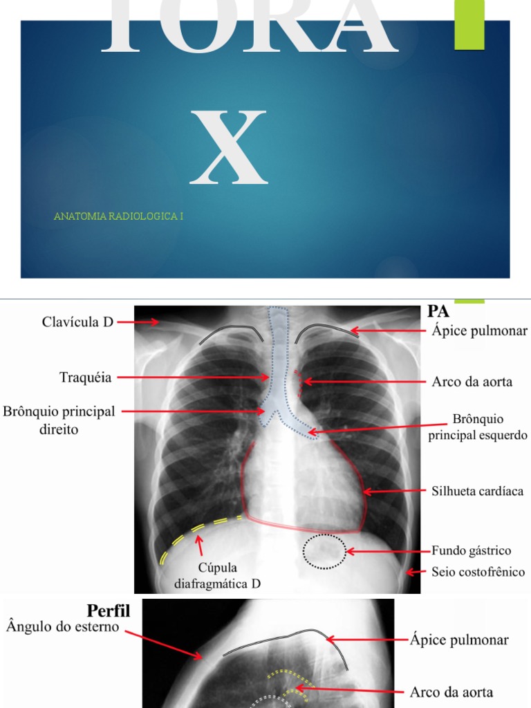 Anatomia Torax | PDF