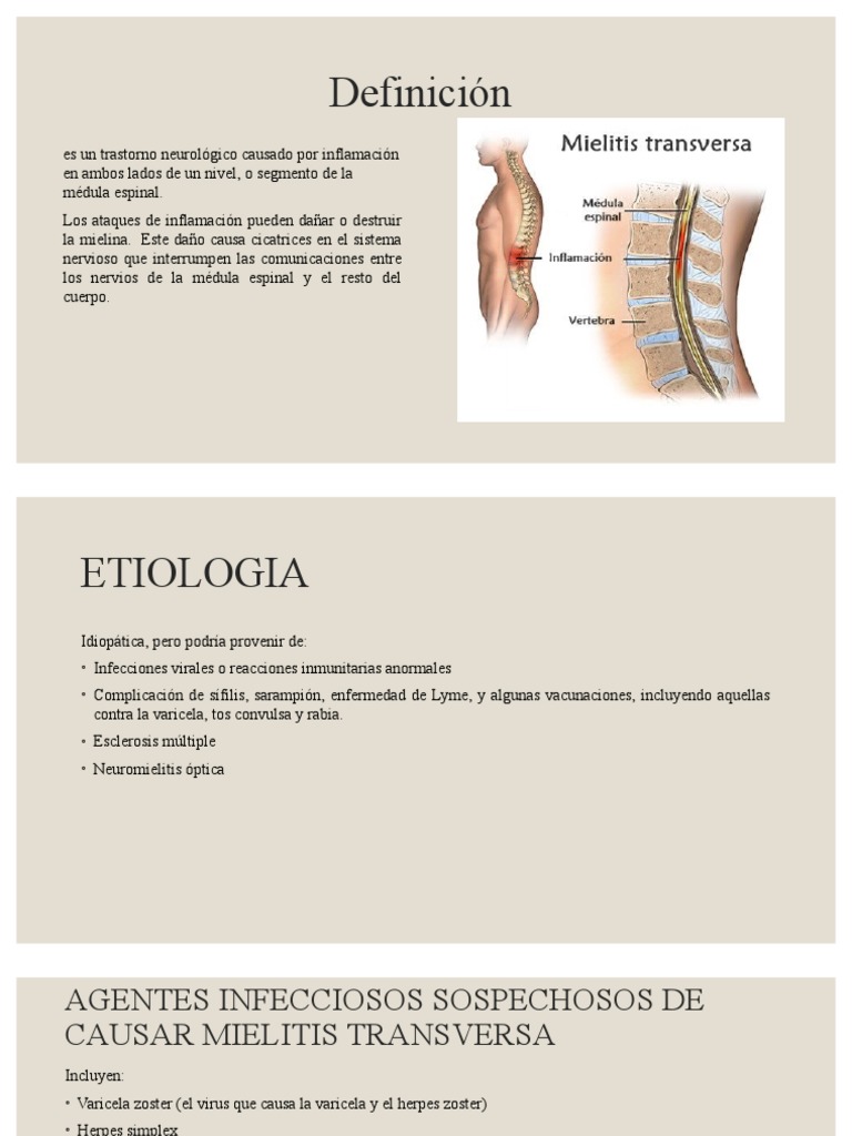 Mielitis Transversa1 | PDF | Rtt | Enfermedades y trastornos