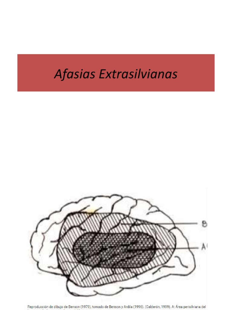 Afasias Extrasilvianas.. | PDF | Afasia | Medicina CLINICA