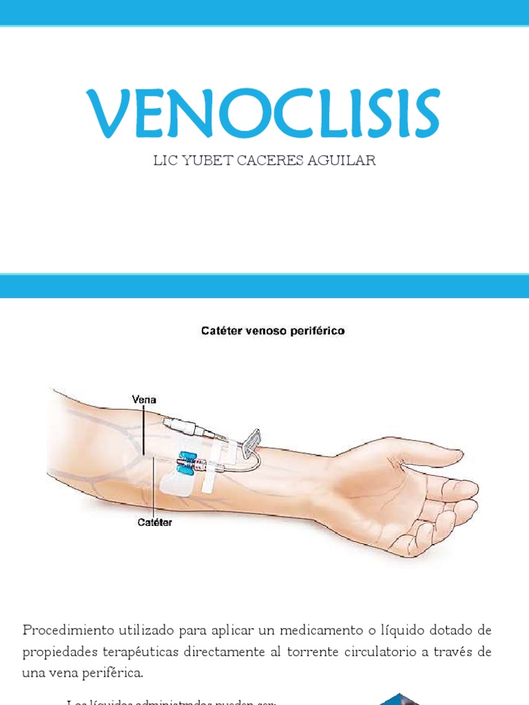 VENOCLISIS | PDF | Terapia intravenosa | Choque (circulatorio)