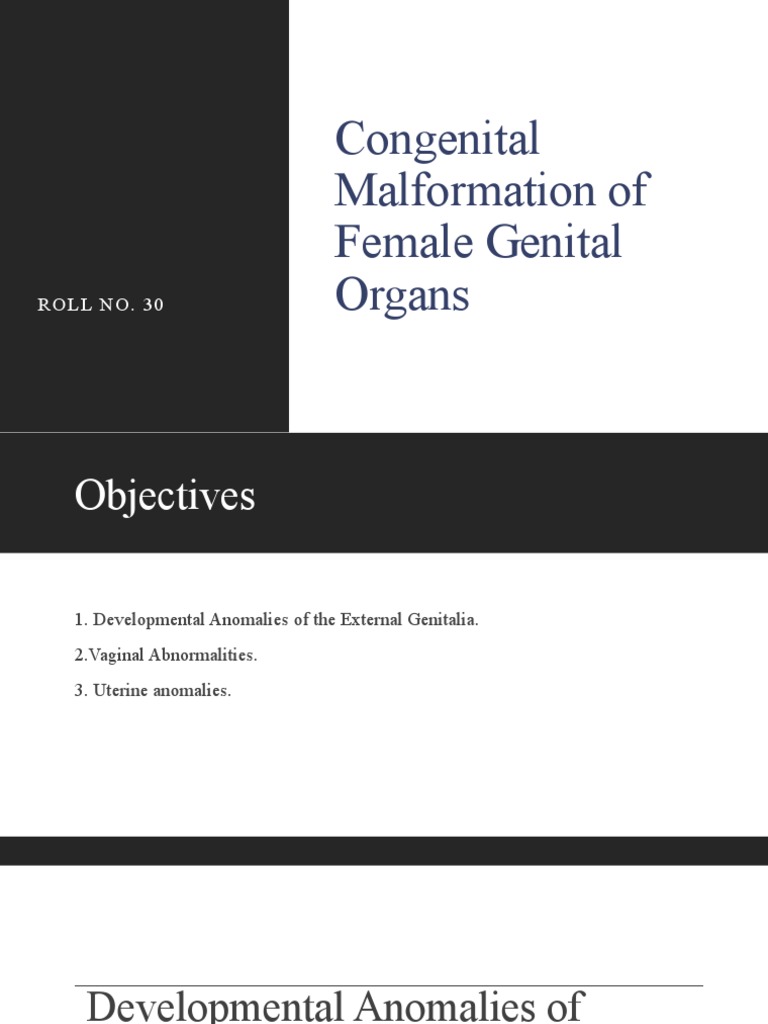 Malformations of Female Genital Organs | PDF | Vagina | Uterus