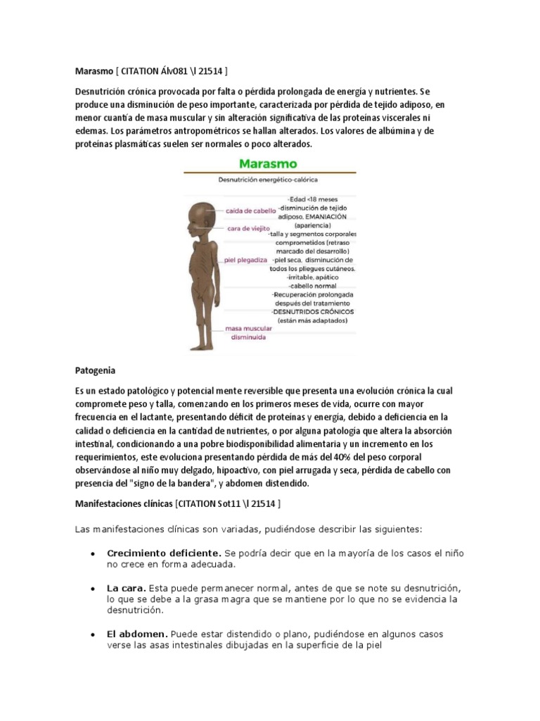 Marasmo | PDF | Sistema inmune | Desnutrición