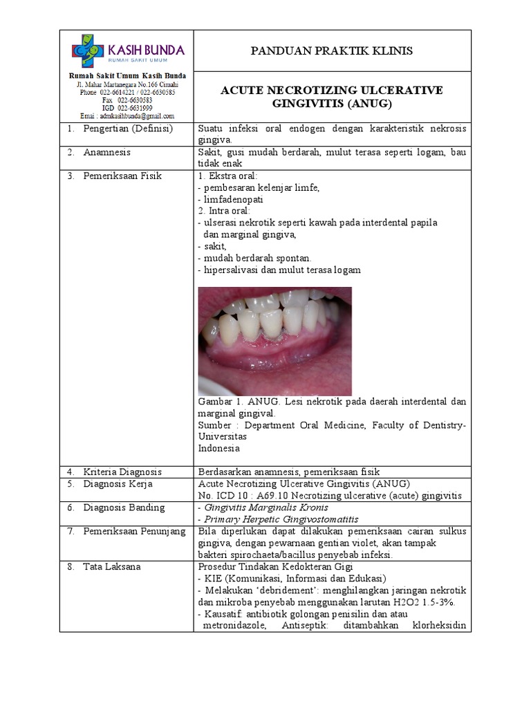 Acute Necrotizing Ulcerative Gingivitis | PDF