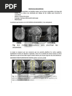 PROTOCOLO RADIOGRAFICO DE PIERNA Corregido | PDF | Rodilla | Tobillo