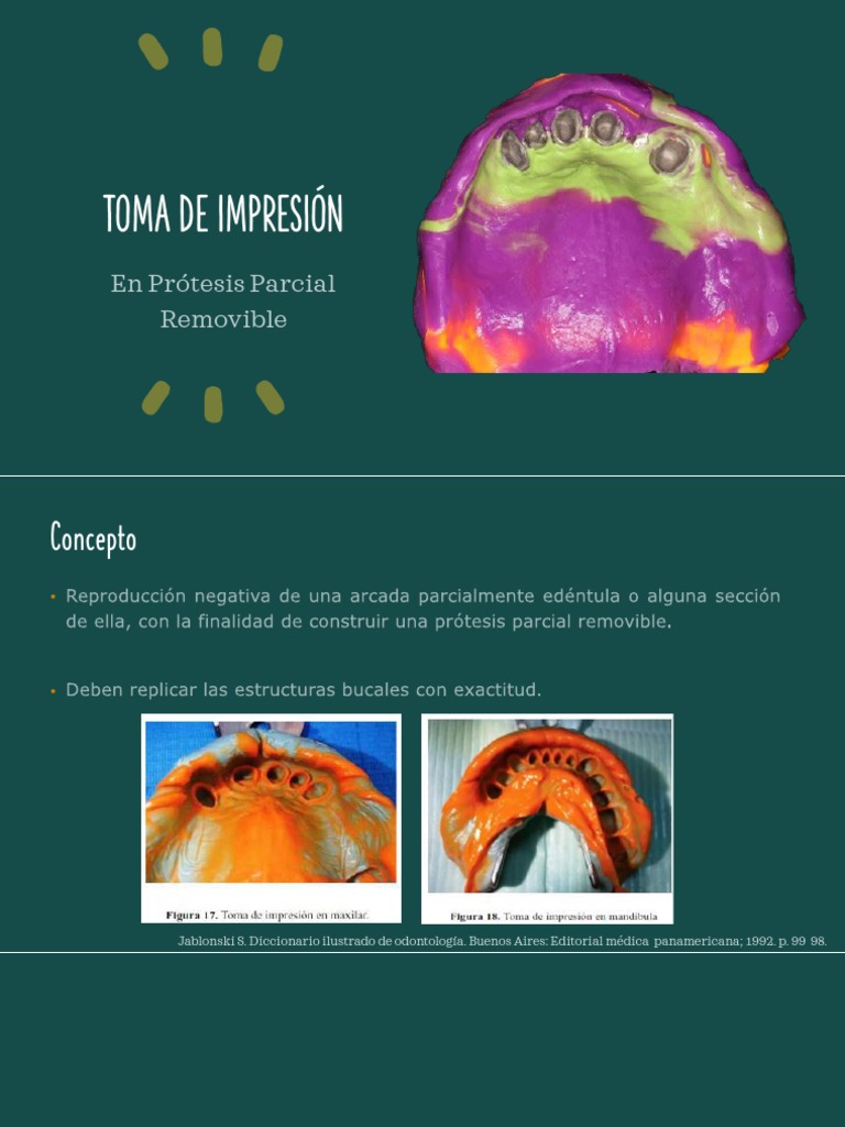 Selección de materiales y técnicas de impresión en prótesis parcial ...