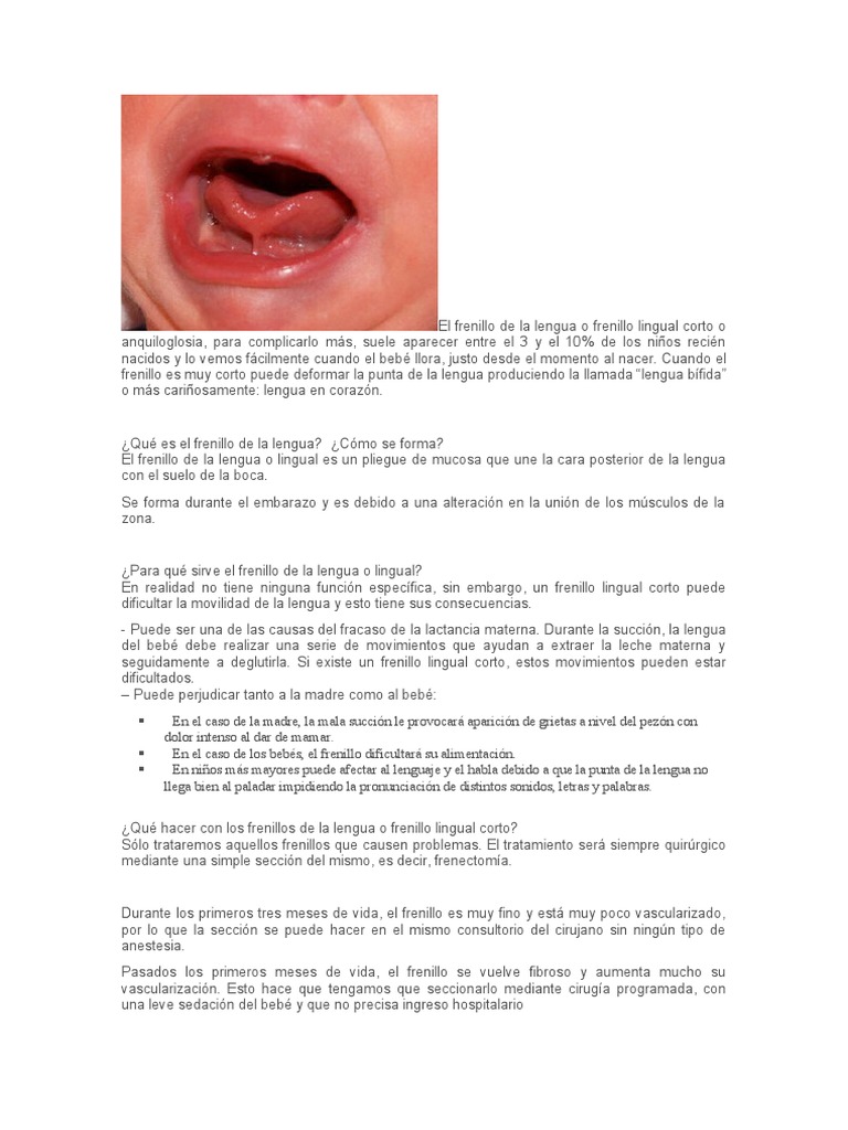 Frenillo Lingual Corto en Bebés: Guía Clínica | PDF